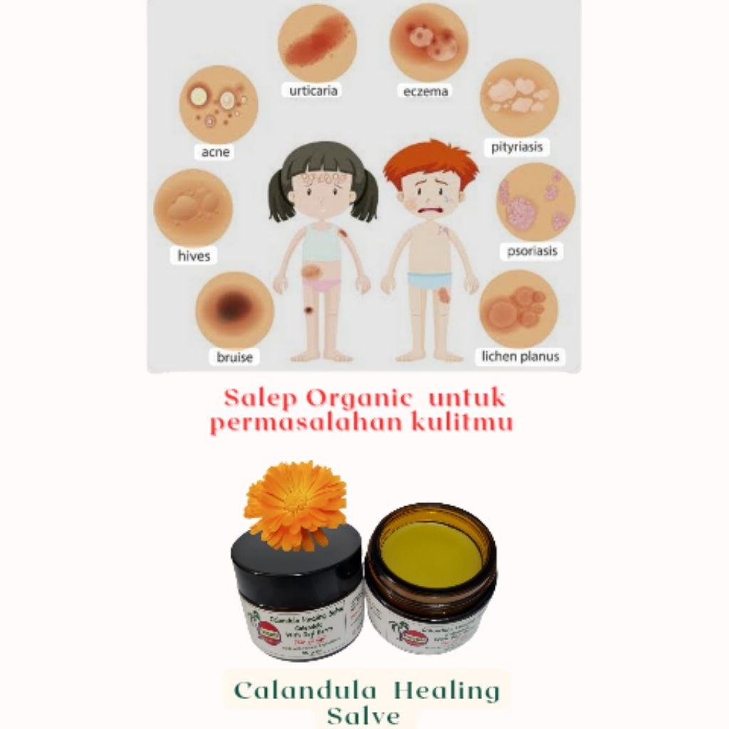 Jual Pureganta Calendula Healing Salve -100% Natural Herbal Pure- all ...