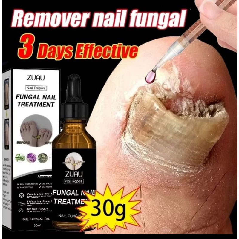 Jual NAIL REPAIR Essence ifeksi jamur kuku botol 30ml | Shopee Indonesia