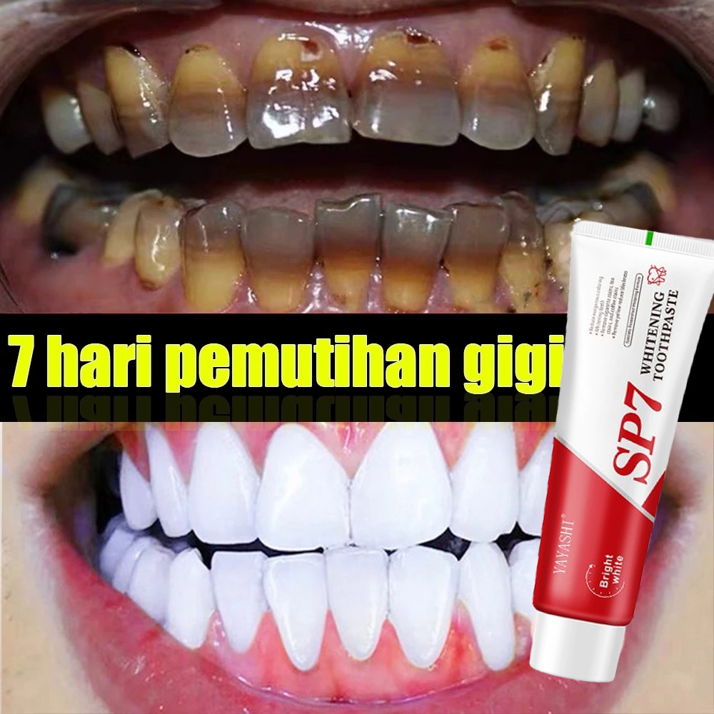 Jual sp7 pemutih gigi original odol pemutih gigi dan karang gigi pasta ...