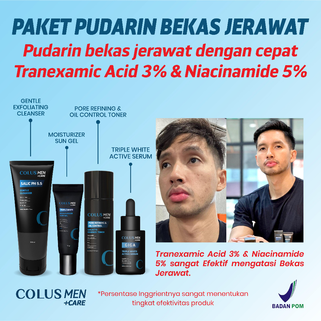 Jual COLUS MEN Paket Skincare PUDARIN BEKAS JERAWAT | Skincare Pria ...