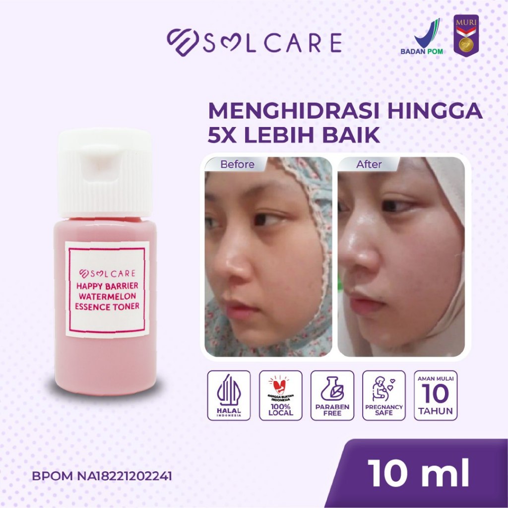 Jual Solcare Happy Barrier Watermelon Essence Toner 10ml | Shopee Indonesia
