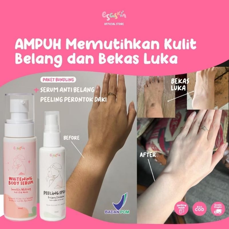 Jual Esaskin Official Beauty - Esa Skin 1 Paket Whitening Body Serum ...