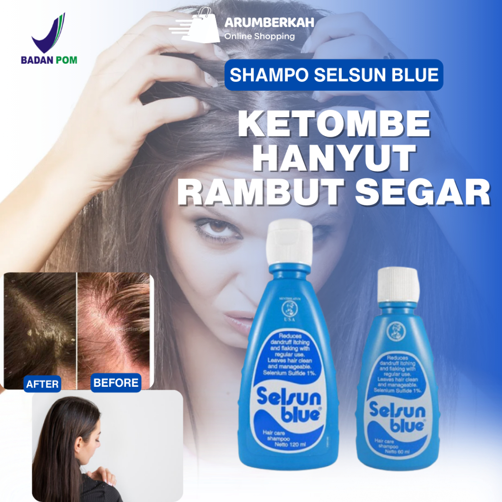 Jual Sampo Selsun Blue Anti Ketombe Dan Rambut Rontok Shampo Buat Rambut Rontok Parah Obat ...