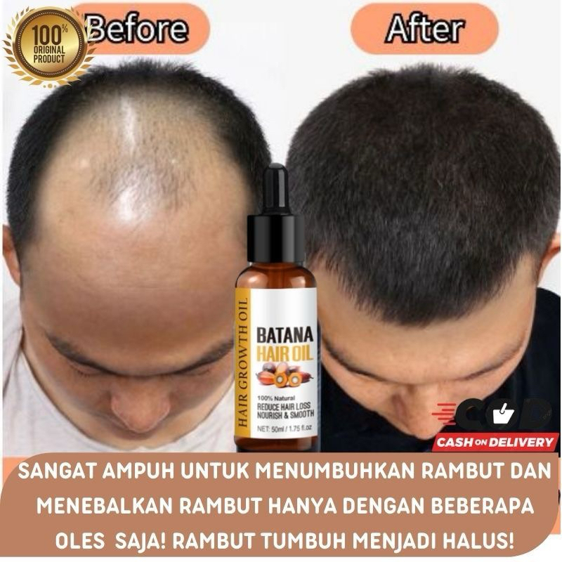 Jual BATANA HAIR OIL Serum anti botak hair growth care serum penumbuh ...
