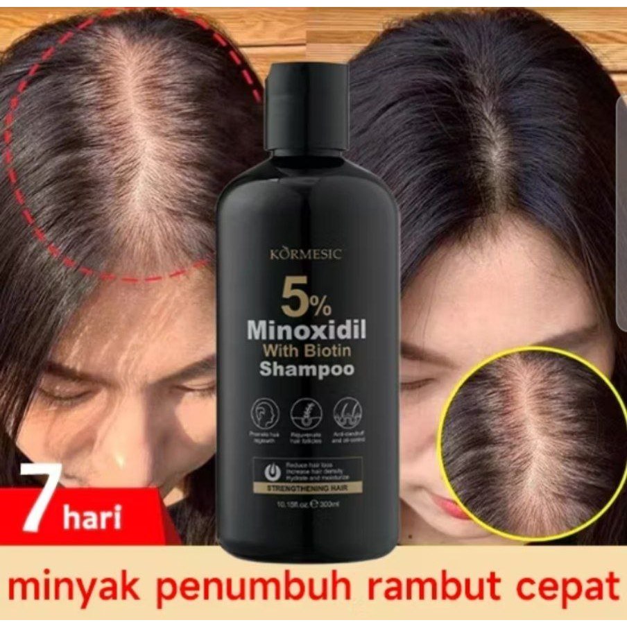 Jual NEW ESSENTIAL OIL BIOTIN COLD-PRESSED DHT BLOCKER HAIR CONDITIONER ...
