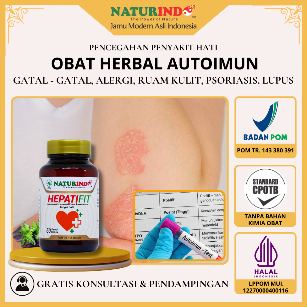 Jual Obat Autoimun Psoriasis Herbal Lupus Gatal Biduran Ruam Merah Imun ...