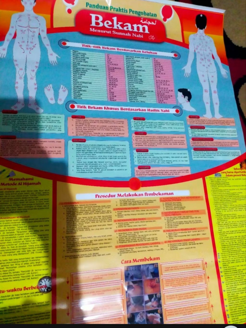 Jual Poster Bekam, Poster Titik Bekam, Poster Panduan Bekam, Poster ...