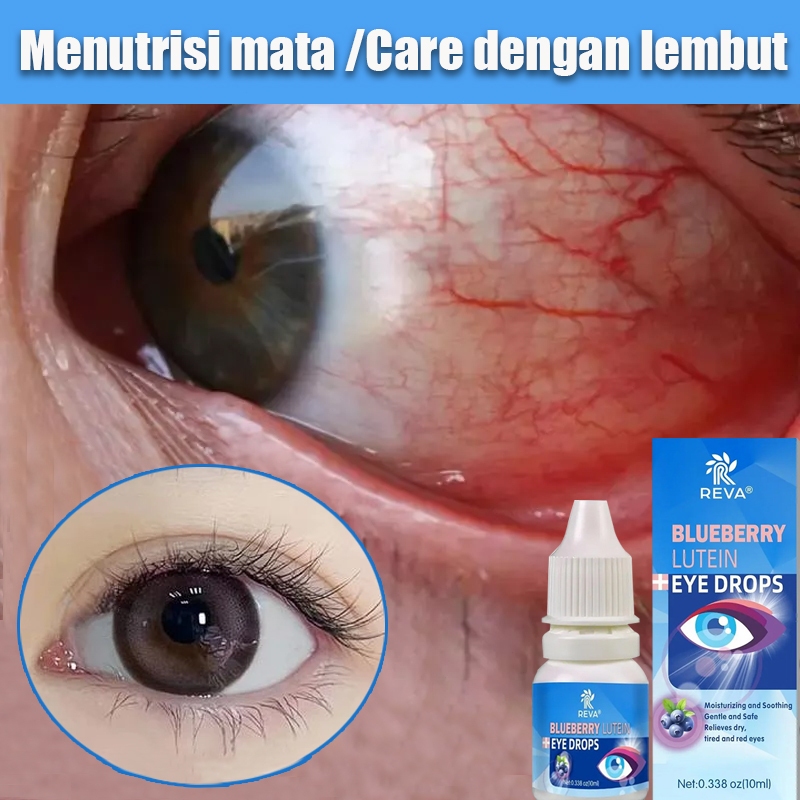 Jual Obat tetes mata lutein atasi katarak mata kering mata lelah ...