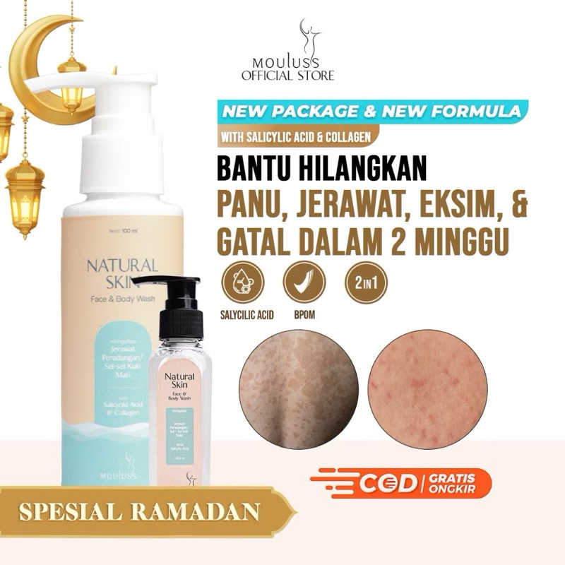 Jual (GARANSI 100%) Mouluss Natural Skin - Menghilangkan panu, gatal ...