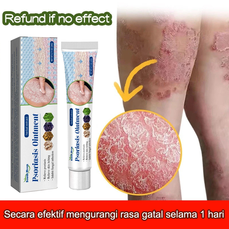 Jual Psoriasis ointment Obat oles infeksi kulit Obat gatal Salep ...