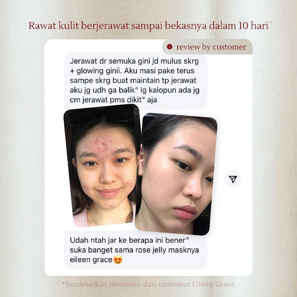 Jual EILEEN GRACE - Moisturize Rose Jelly Mask 35 ml x2 | Masker ...