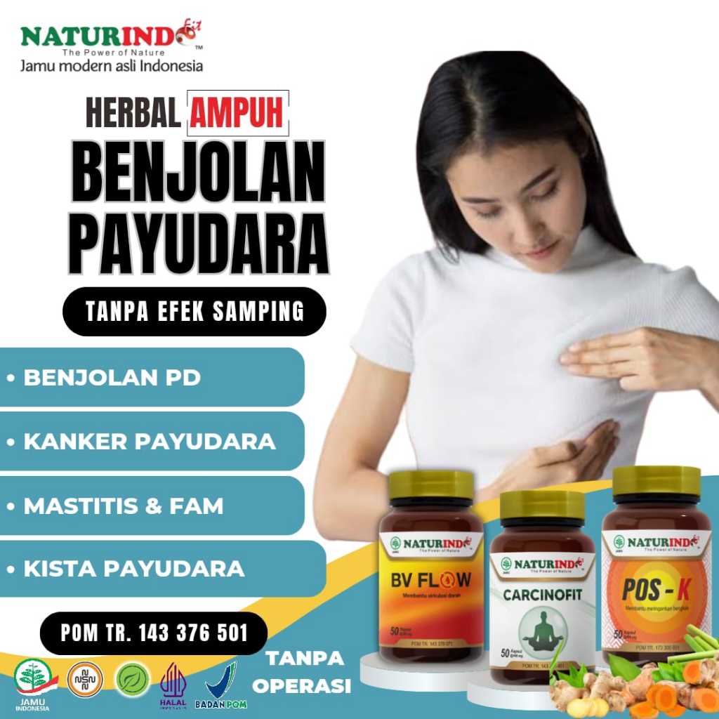 Jual Obat Herbal Benjolan Payudara Kanker Tumor Payudara Bengkak Fam Mastitis Naturindo | Shopee ...