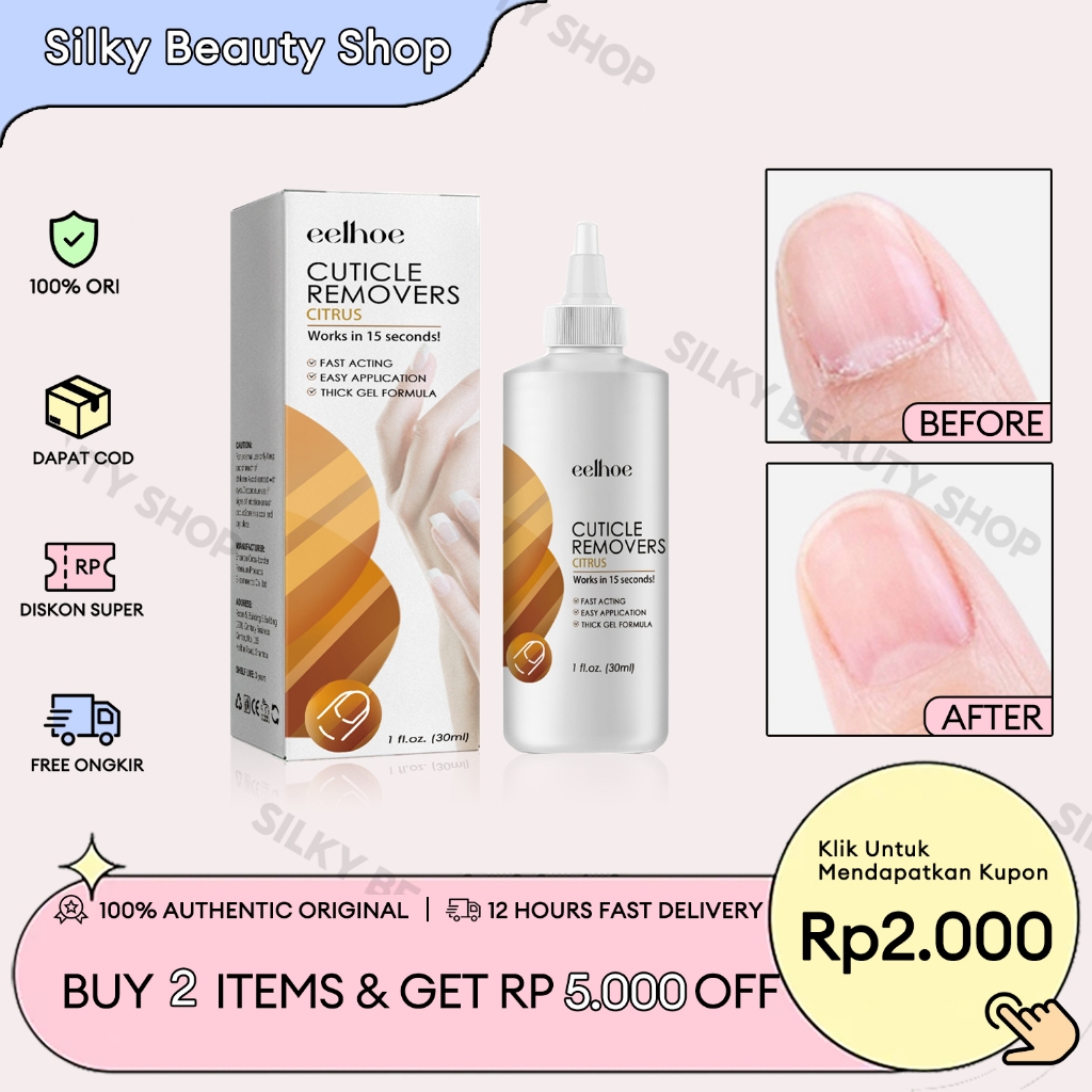 Jual Eelhoe Obat Jamur Kuku 30ml Obat Kuku Jamur Dan Rusak Toe Nail ...