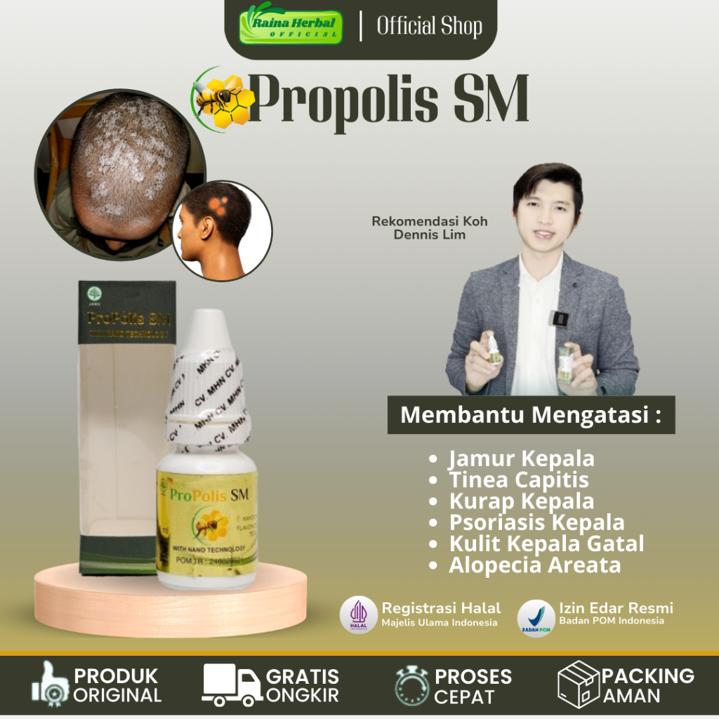 Jual Obat Oles Jamur Di Kulit Kepala, Obat Psoriasis Kepala, Obat Kurap Kepala, Obat Tinea ...