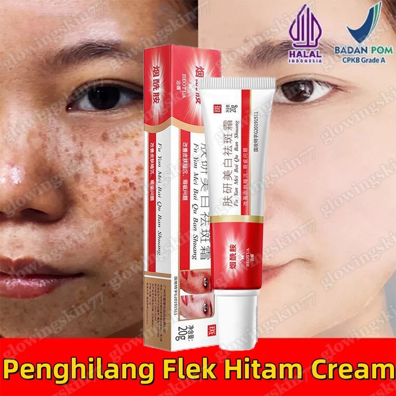 Jual Devnen Cream Penghilang Flek Hitam Cream 20g Pemutih Wajah Niacinamide Whitening Freckle ...