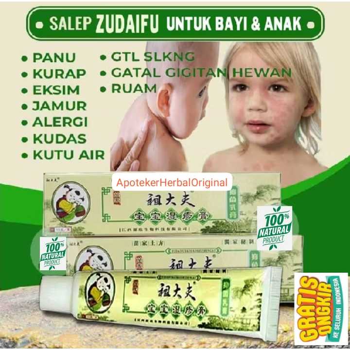 Jual SALEP 𝗚𝗔𝗧𝗔𝗟 𝗔𝗡𝗔𝗞 ORIGINAL MENGOBATI GATAL SELAKANGAN | GATAL ...