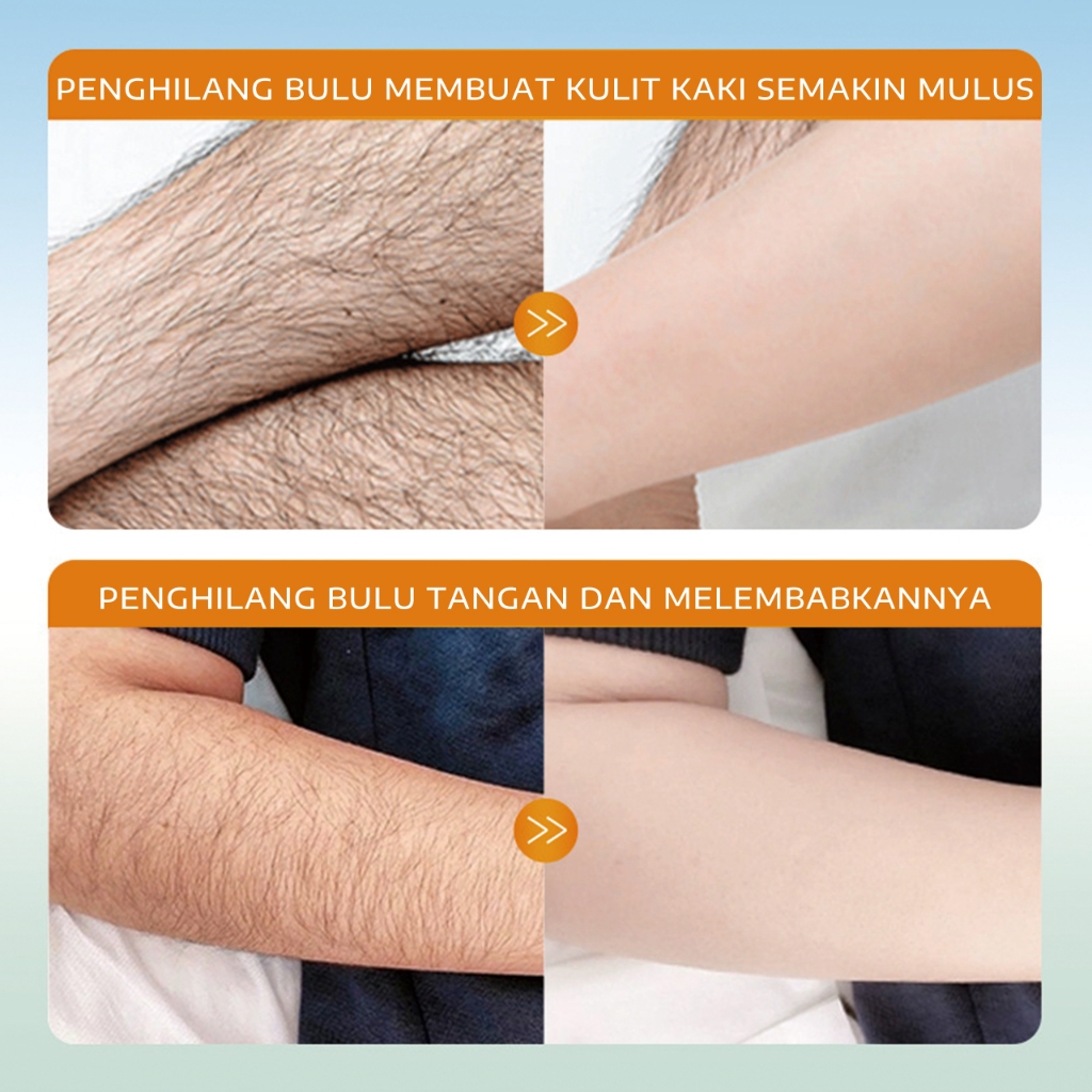 Jual VINNETORA Hair Removal+Soothe Tender Krim Perontok Bulu - Krim ...