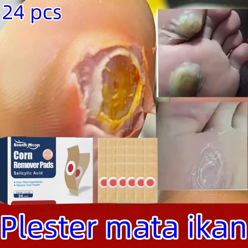 Jual Plester mata ikan Penghilang Kutil mata ikan di kaki plester kutil ...