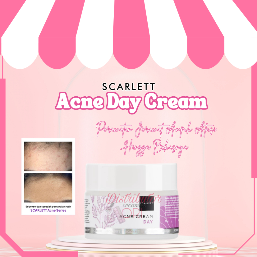 Jual Scarlett Whitening Acne Day Cream | Day acne scralett | scarlett ...