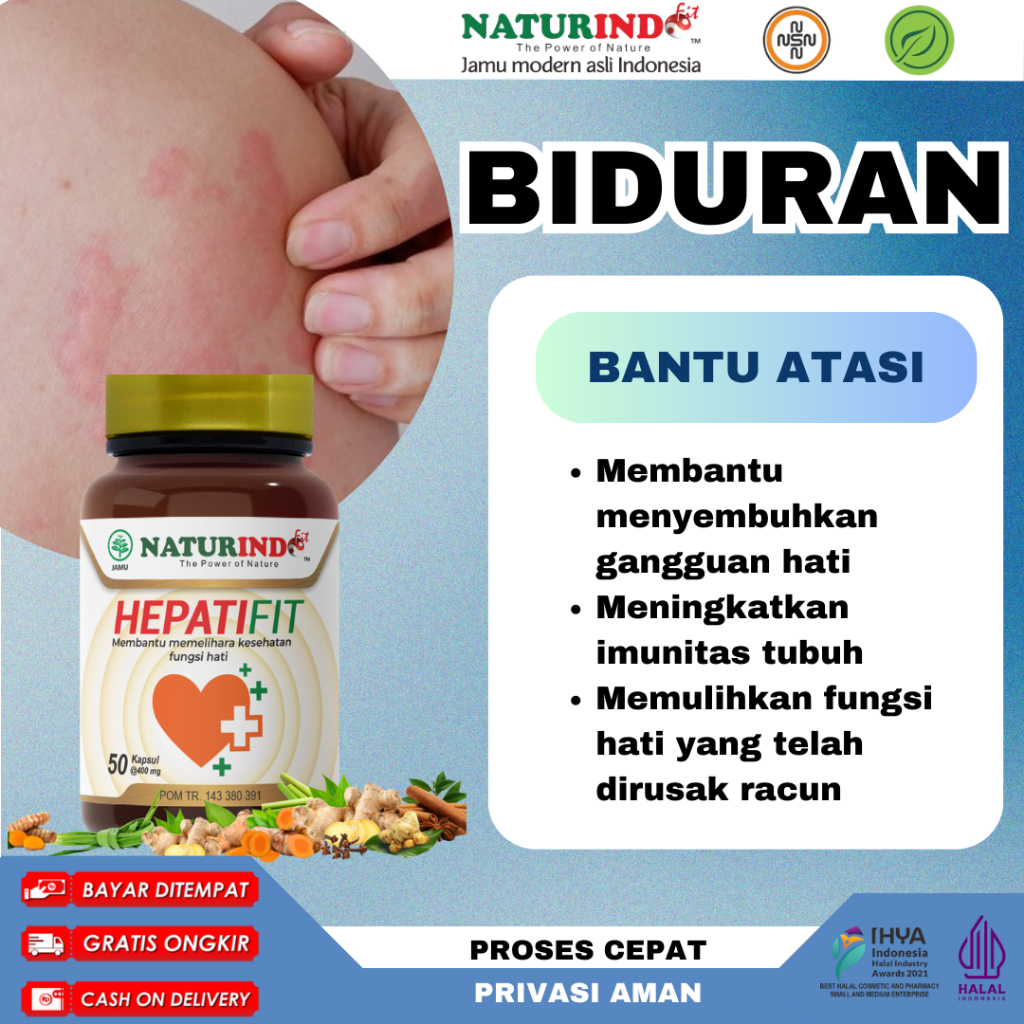 Jual Obat Biduran Batu Empedu Liver Alergi Dingin Gatal Mata Kuning ...