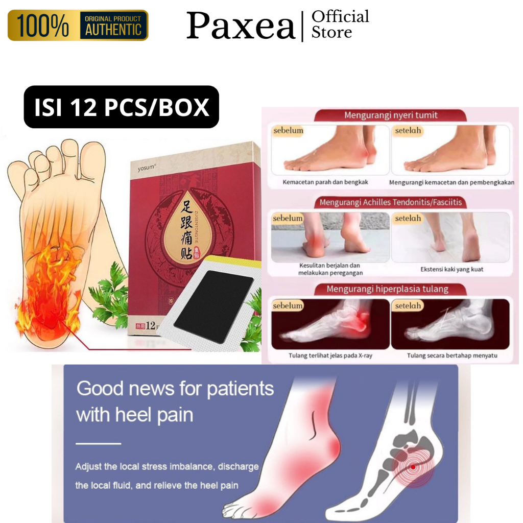 Jual obat sakit tumit Plantar fasciitis terapi Koyo kaki pereda nyeri ...