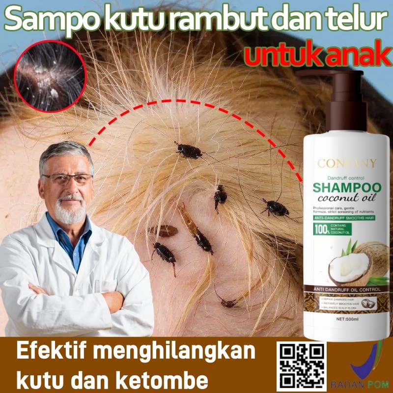 Jual Shampoo Kutu Rambut Anak Dan Dewasa Coconut Shampoo Anti Ketombe Dan Gatal Sampo Penghilang ...