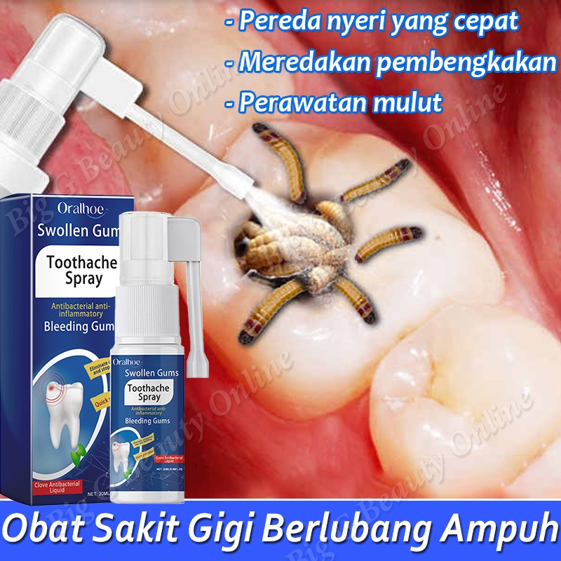 Jual Obat Sakit Gigi Semprot Obat Sakit Gigi Berlubang Oral Perawatan ...