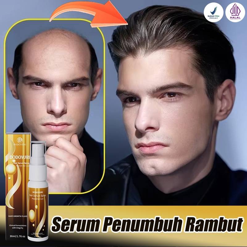 Jual obat penumbuh rambut minyak kemiri penumbuh rambut penumbuh rambut ...
