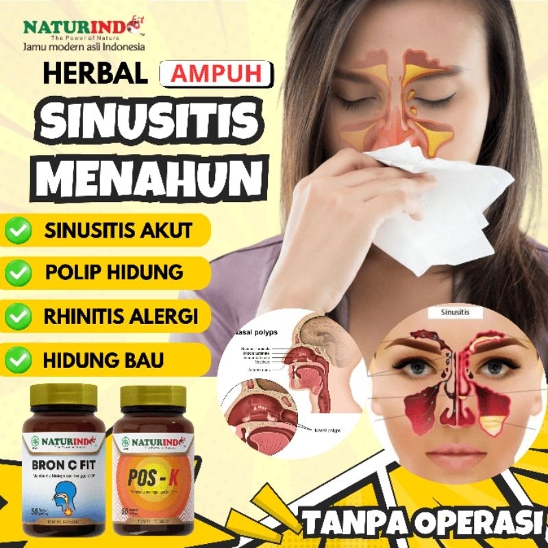 Jual Obat Sinusitis Polip Hidung Rhinitis Alergi Sinus Hidung Bau Busuk Bron C Fit | Shopee ...