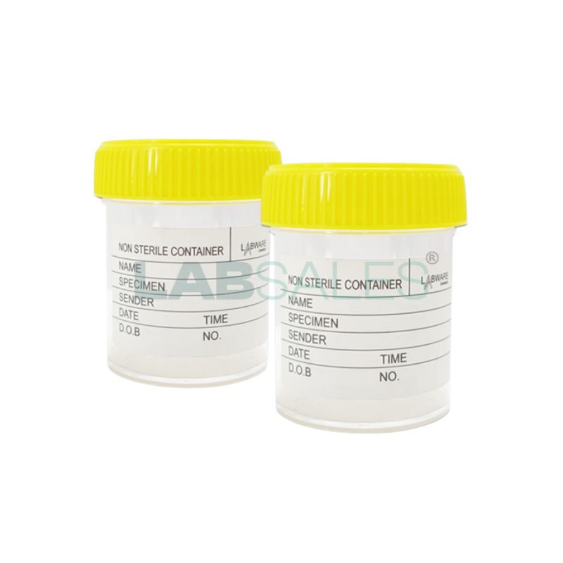 Jual Pot Urine Specimen Container 60ml Non Sterile Kuning Labware ...