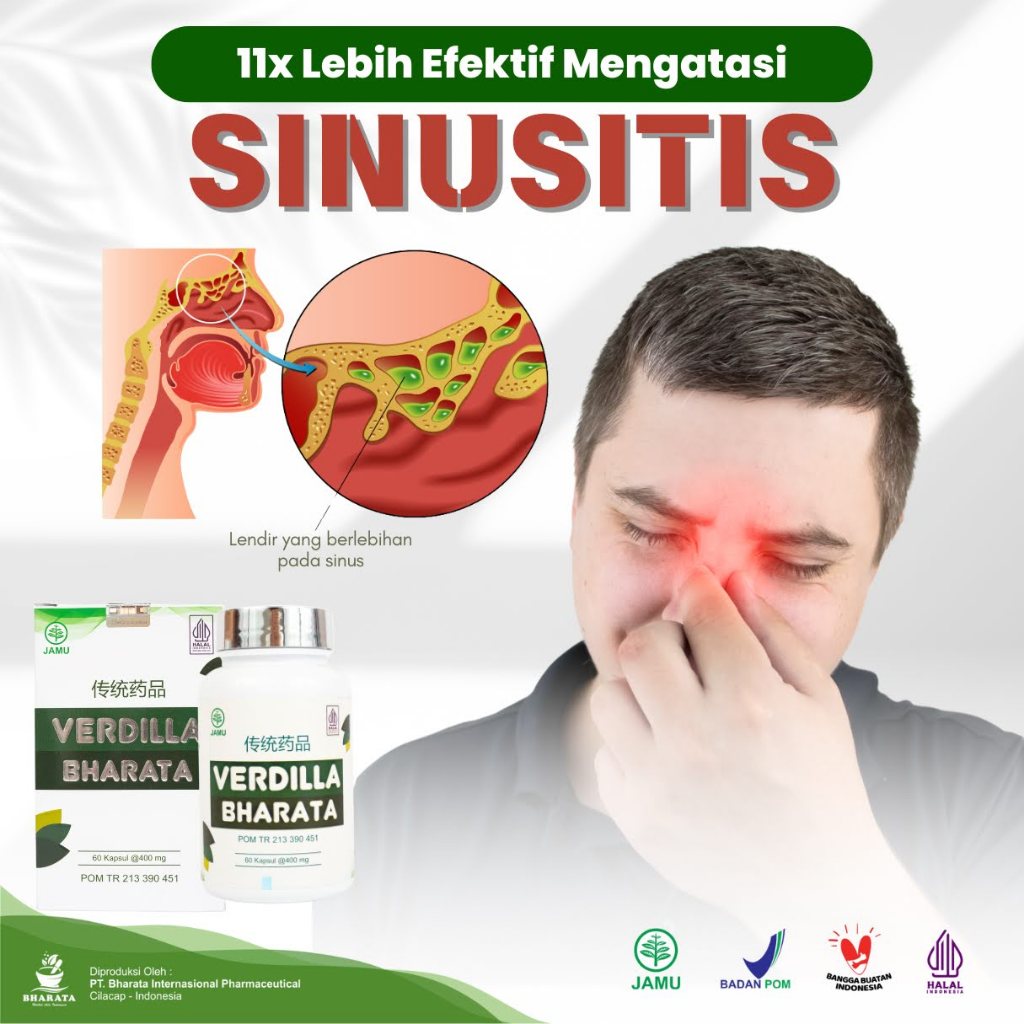 Jual Obat Sinusitis Ampuh - Sinus Hidung - Polip Hidung || Verdilla ...