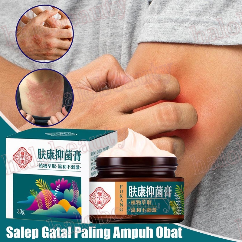 Jual Salep Gatal Paling Ampuh Obat Psoriasis Obat Gatal Salep Kutil ...