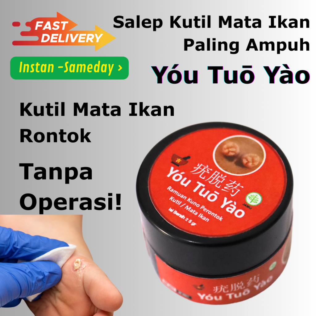 Jual Obat Mata Ikan - You Tuo Yao - Salep Mata Ikan Paling Ampuh Kutil ...