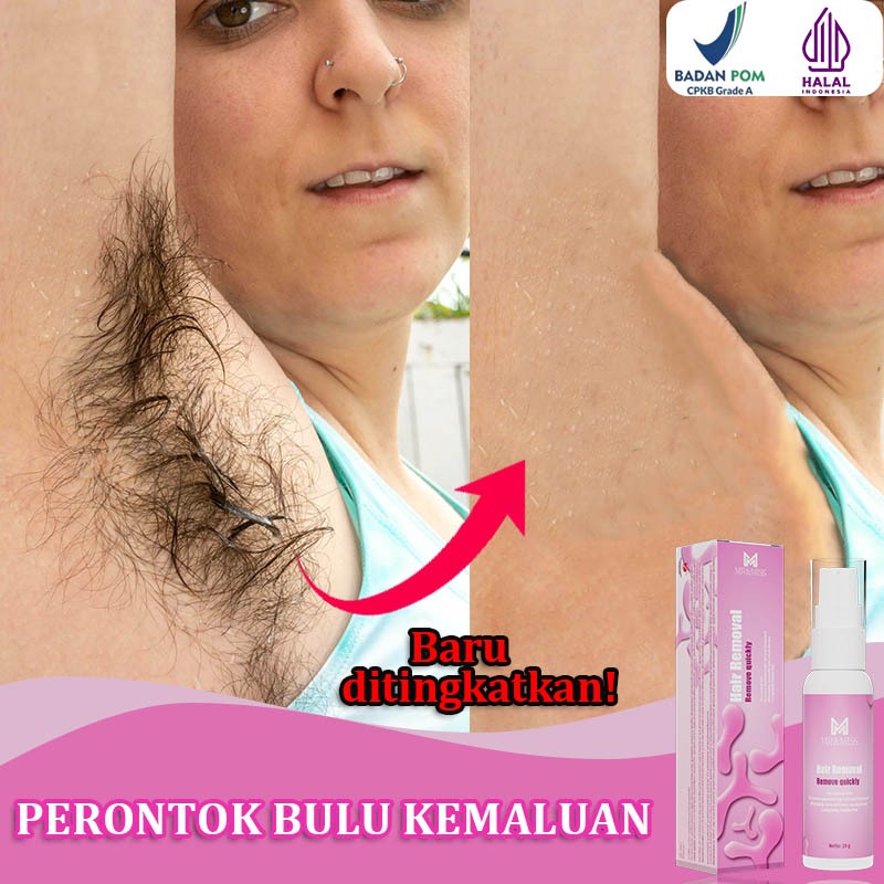 Jual Perontok bulu permanen perontok bulu kemaluan penghilang bulu ...