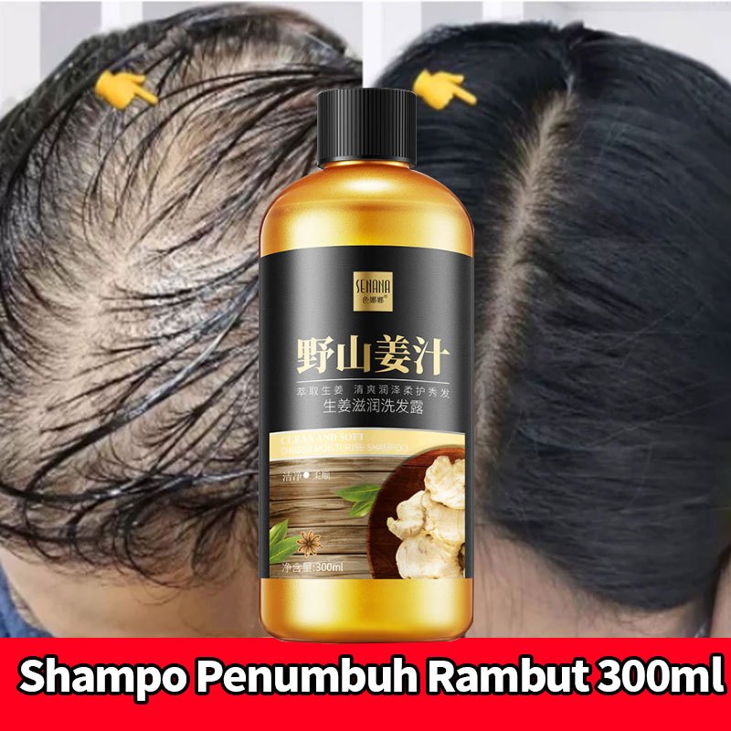 Jual Ginger Shampoo 300ml Pertumbuhan rambut Pengendalian Minyak Anti rambut rontok Botak shampo ...