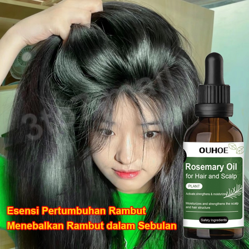 Jual Rosemary Oil penumbuh rambut pelebat rambut penumbuh rambut botak ...