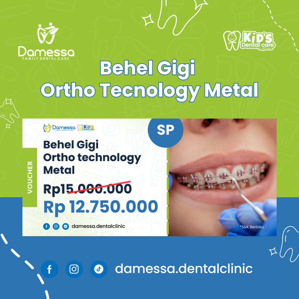 Jual Voucher Behel Gigi Damessa - Pasang Behel Gigi Orthotecnology Metal with Specialist Dentist ...