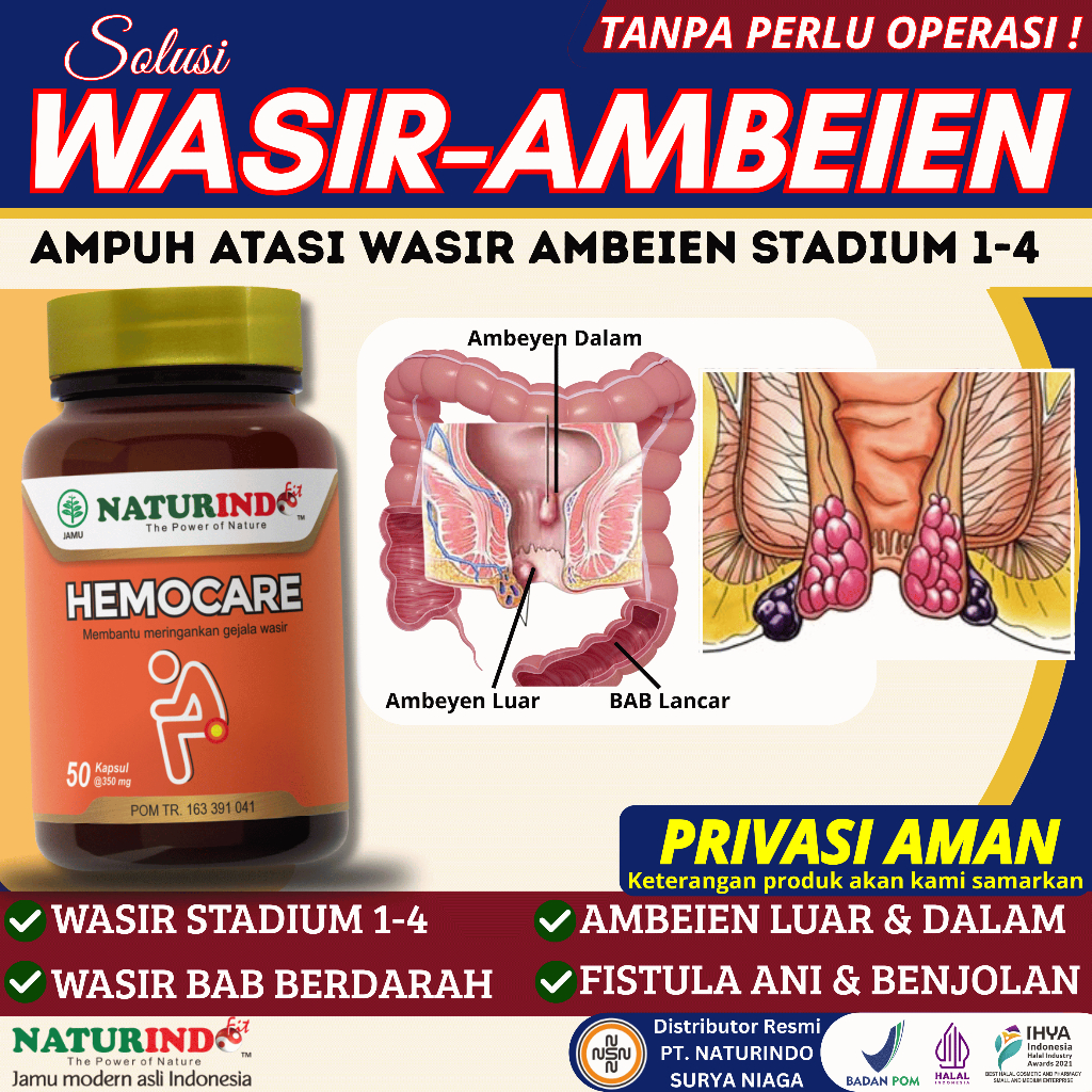 Jual Obat Wasir Ambeien Stadium 1-4 Benjolan di Anus Luar Dalam Tanpa ...