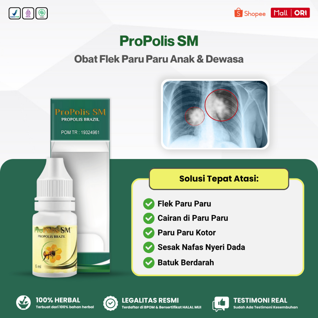 Jual Propolis SM - Obat Flek Paru Paru, Pembersih Paru Paru, Penghilang ...