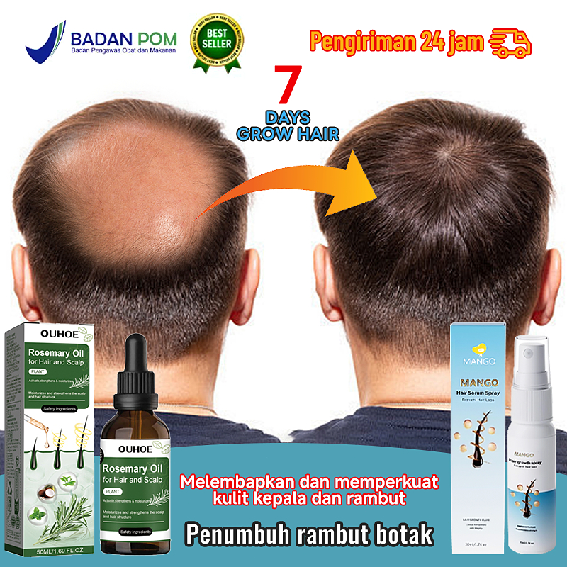 Jual 【BPOM】Serum penumbuh rambut penumbuh rambut botak obat penumbuh ...