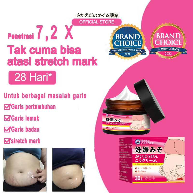 Jual 4 Minggu Pudar Stretch Marks【100%ORI】stretch mark cream stretch ...