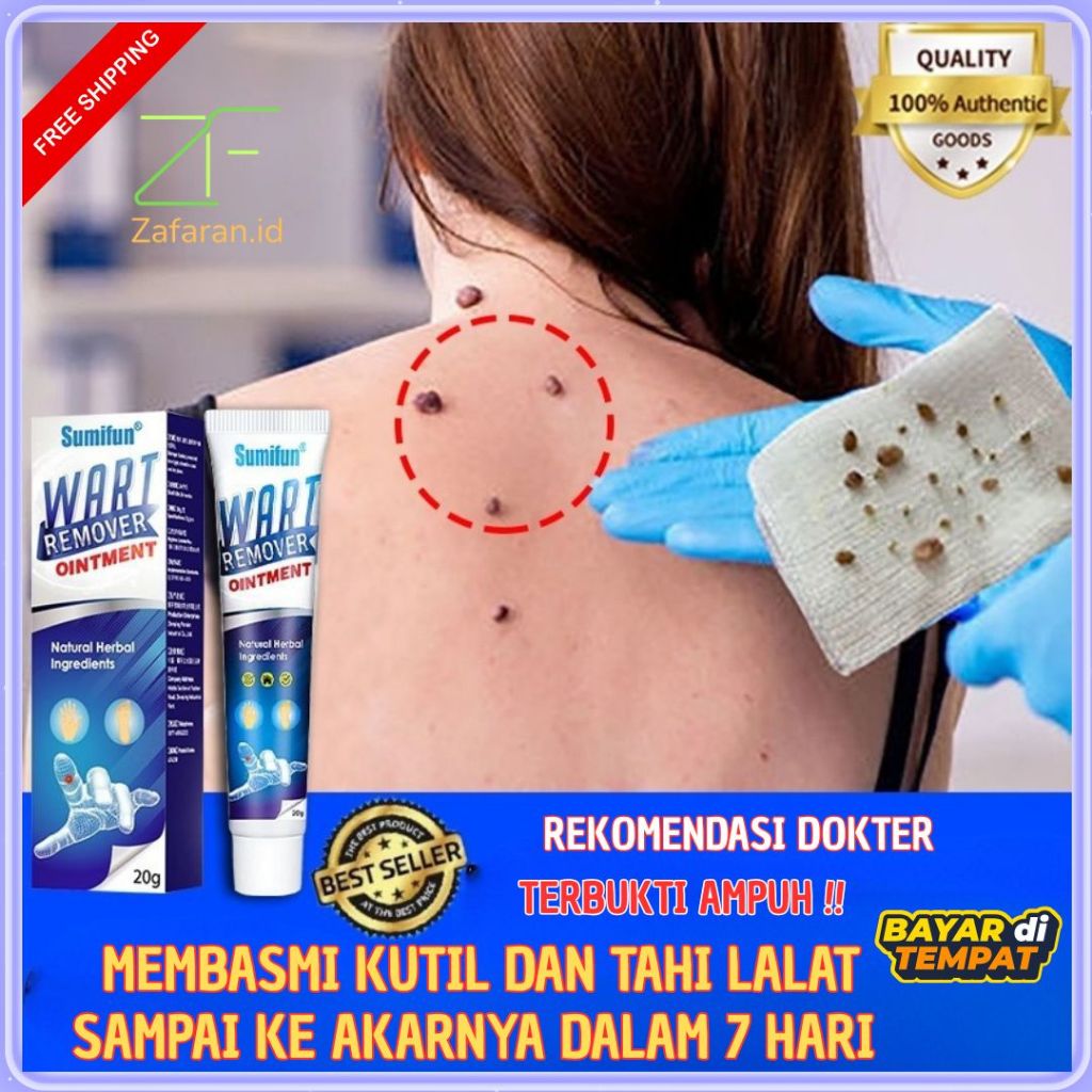 Jual 𝗦𝘂𝗺𝗶𝗳𝘂𝗻 𝗪𝗮𝗿𝘁 𝗥𝗲𝗺𝗼𝘃𝗮𝗹 𝗦𝗸𝗶𝗻 𝗧𝗮𝗴 Eelhoe Wart Remover 100% Original ...