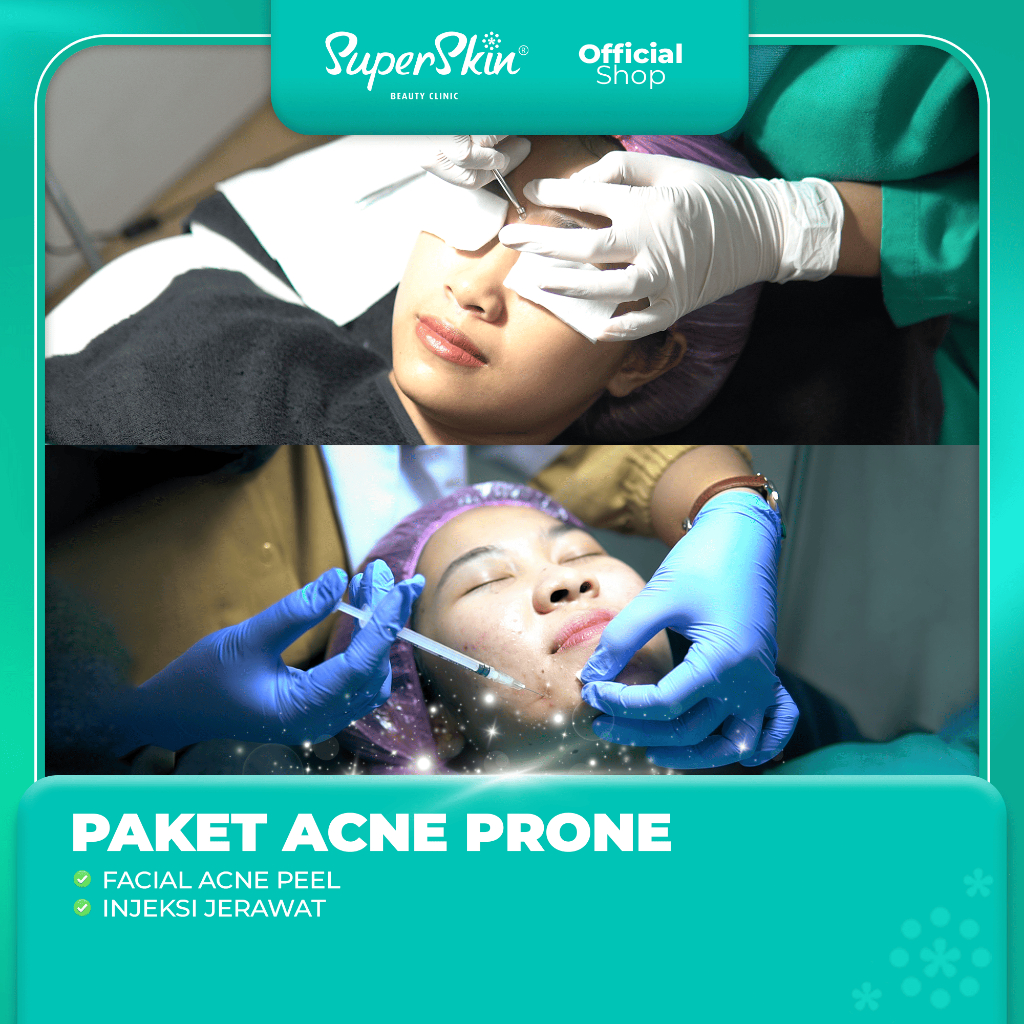 Jual Paket Acne Prone: Facial Acne Peel dan Injeksi Jerawat | Shopee ...