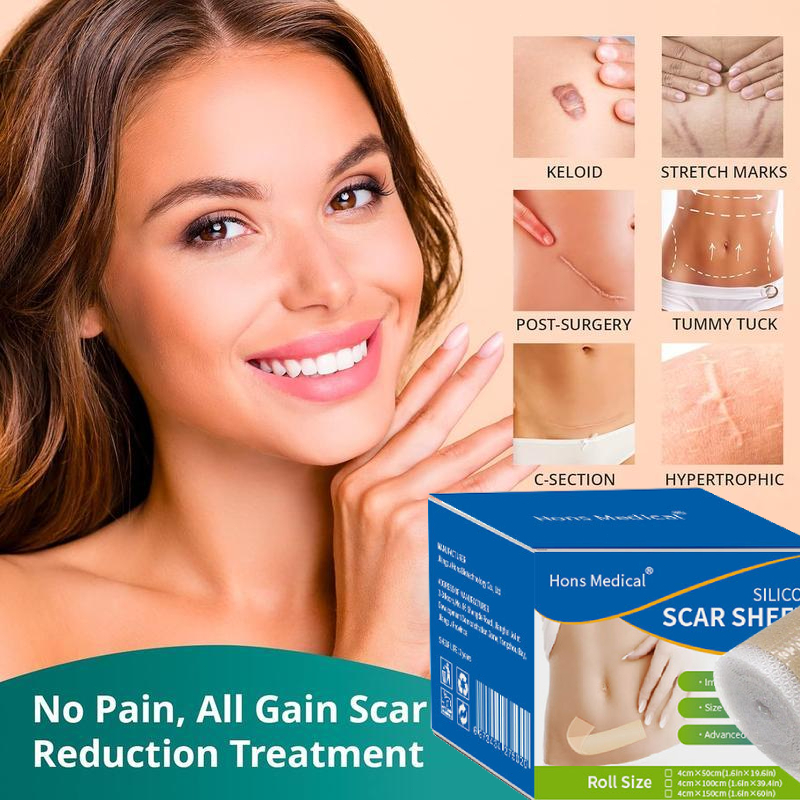 Jual Tambalan bekas luka penutup bekas luka operasi caesar mengangkat ...