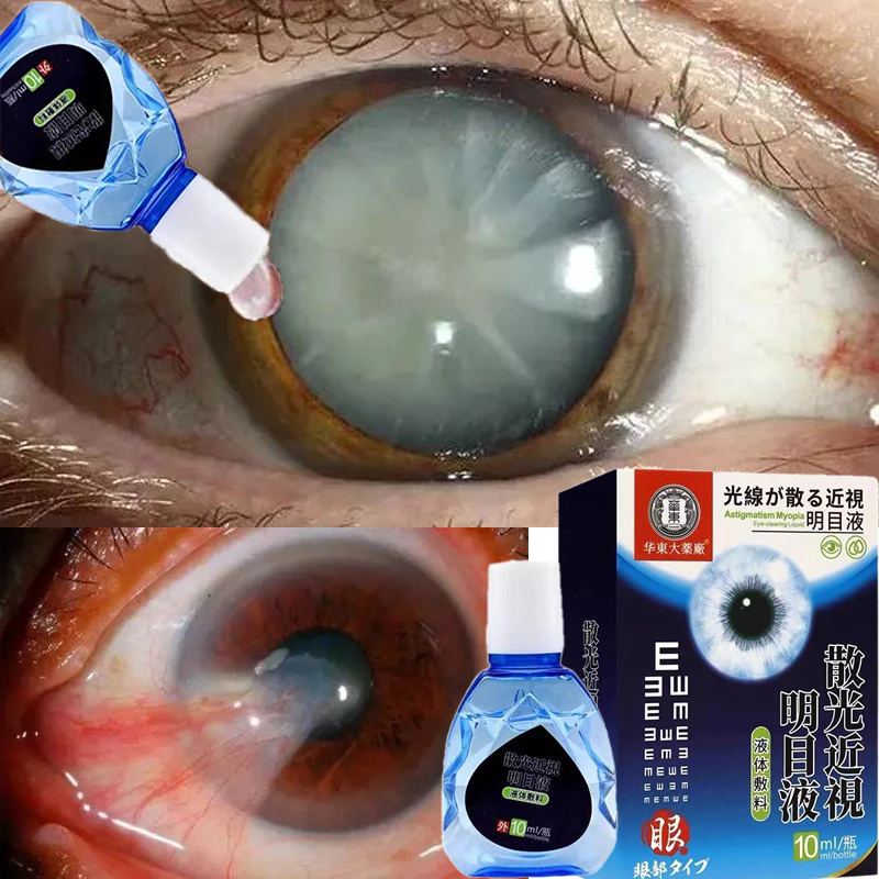 Jual Obat Tetes Mata Obat Mata Katarak Eye Drop Obat Mata Buram Obat ...