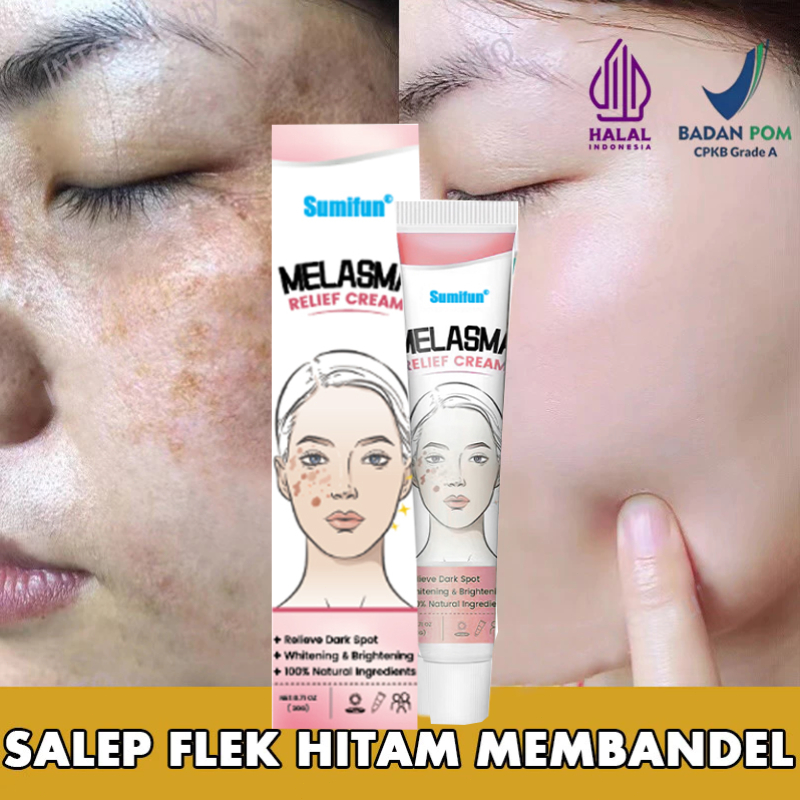 Jual Sumifun cream penghilang flek hitam salep melasma flek hitam membandel 20g cream flek dan ...