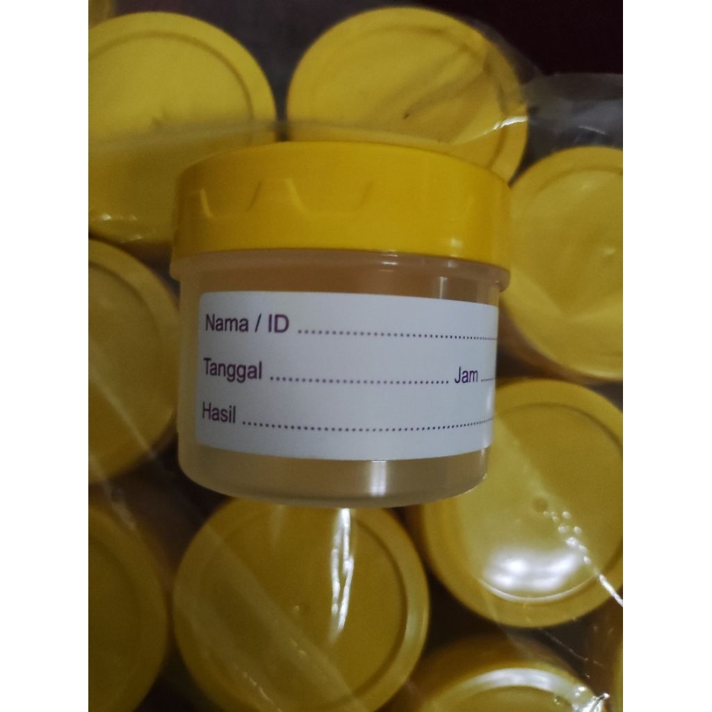 Jual Pot Urine Sample Container Ekomed | Shopee Indonesia