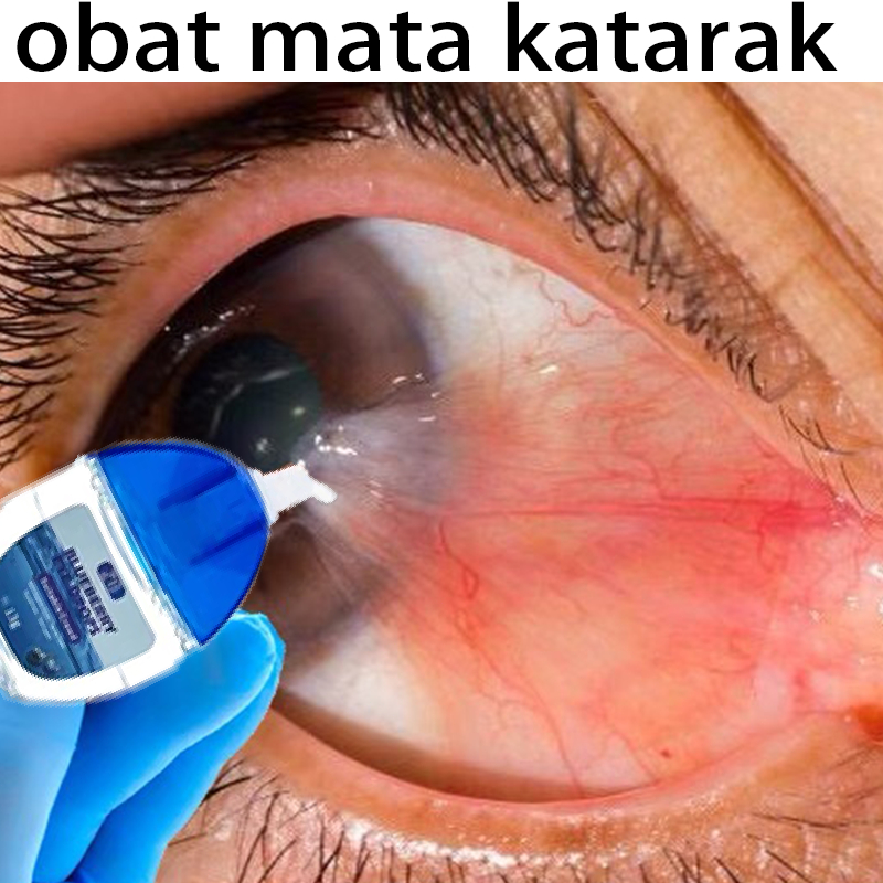 Jual Obat mata katarak Blueberry Eye drop Obat mata merah Pengobatan ...