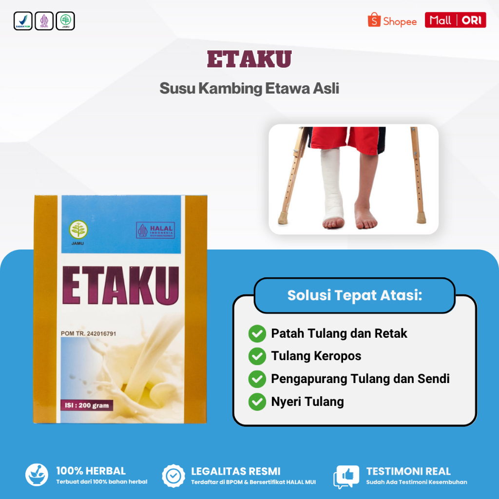 Jual Obat Patah Tulang & Retak, Patah Tulang Kaki Tangan Rusuk Pinggul ...
