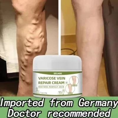 Jual Terlaris !!! Varicose Veins Obat Varises Varikokel Bengkak ...